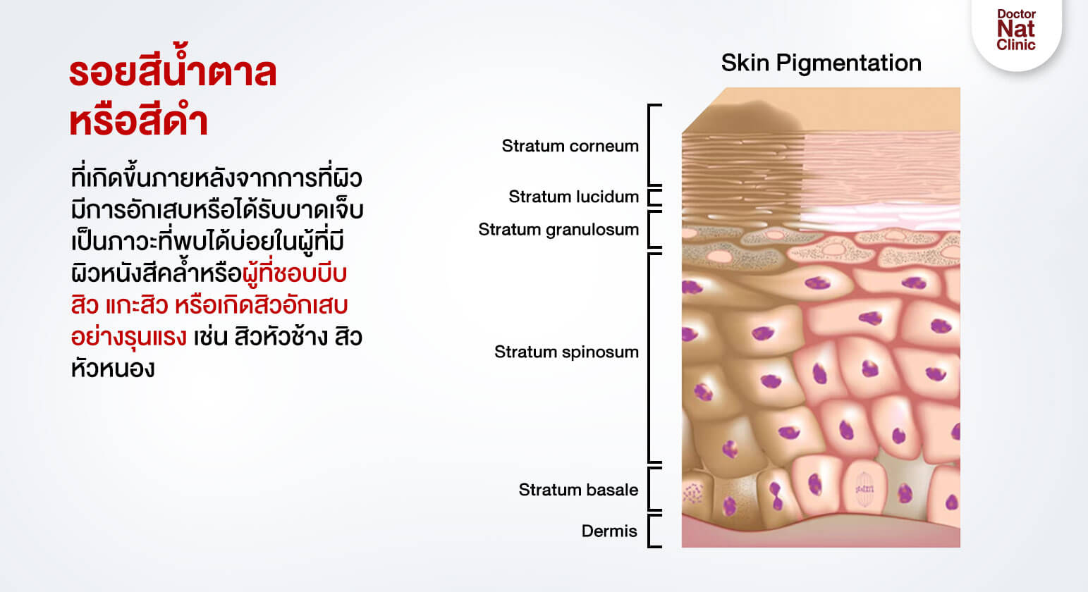 ทำไมรอยสิว มีสีต่างกัน - Doctor NAT Clinic
