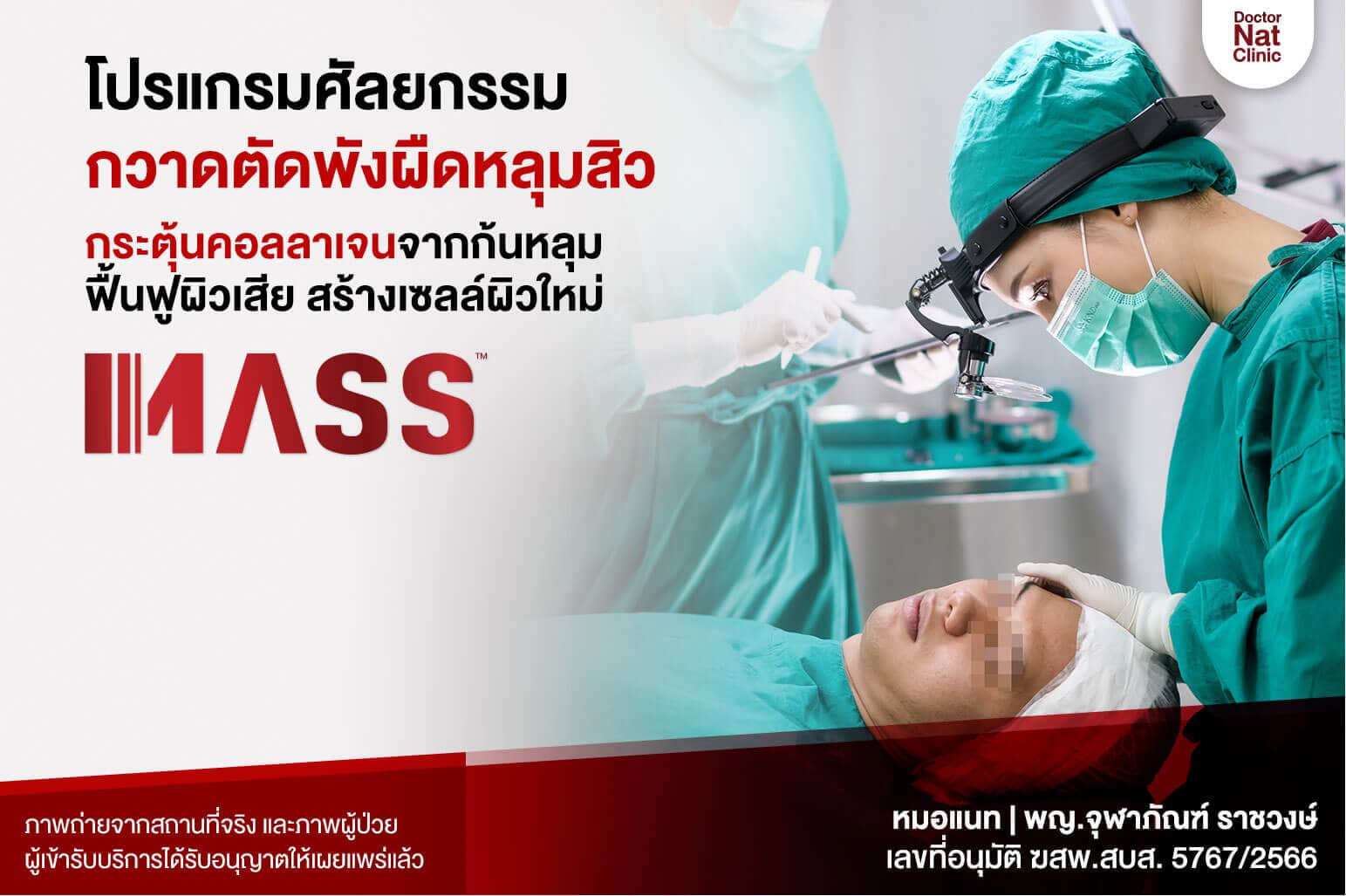 เจ็บมาเยอะกับหลุมสิว - Doctor NAT Clinic