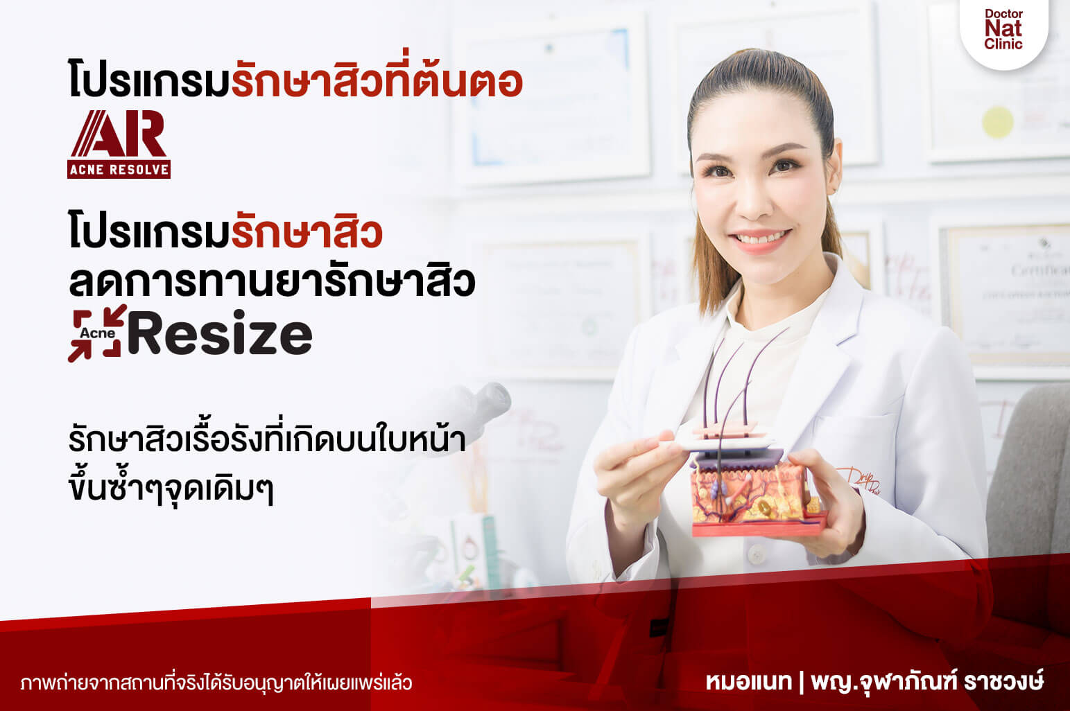 Acne Resolve / Resize - Doctor NAT Clinic