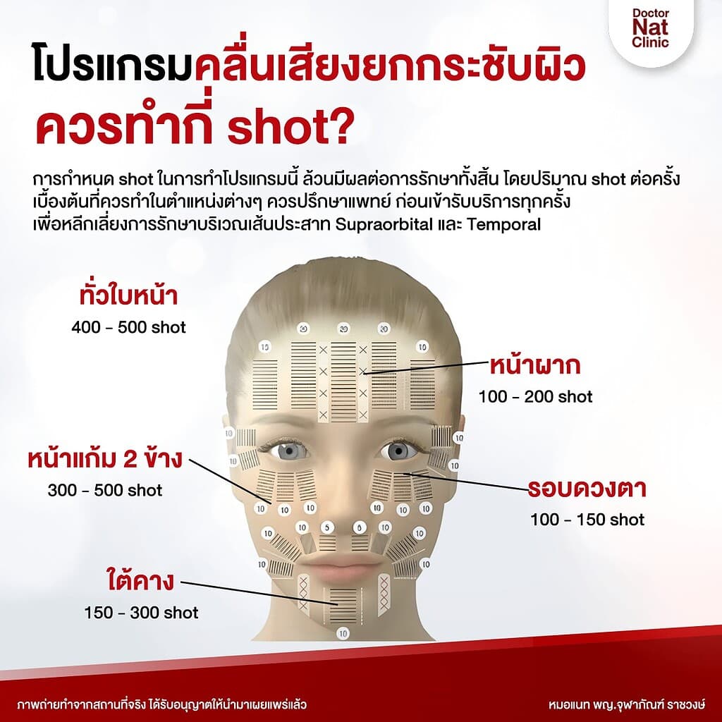 Ultraformer III ยกกระชับหน้า ไม่ต้องผ่าตัด - Doctor NAT Clinic