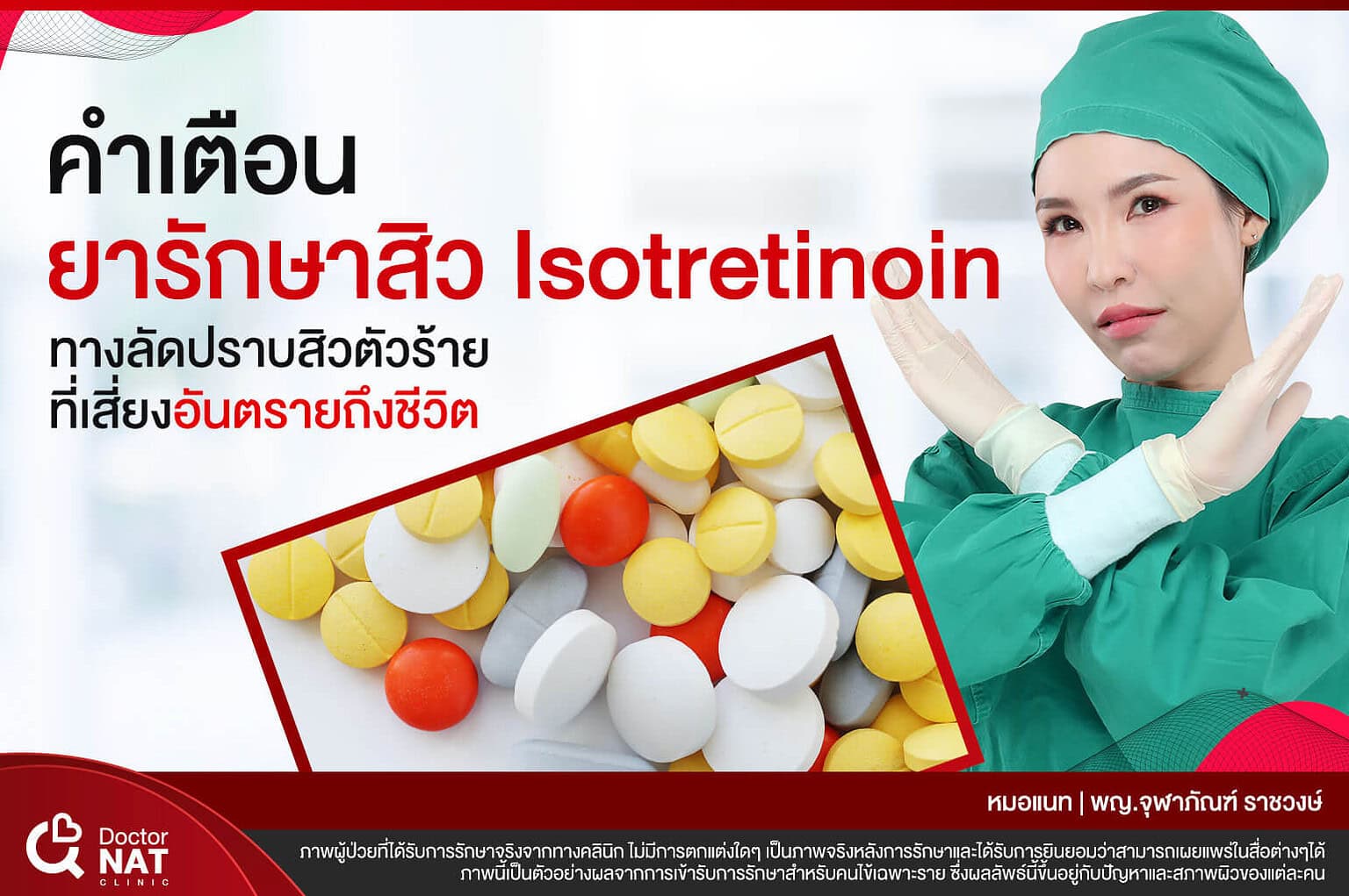 ยารักษาสิว Isotretinoin เสี่ยงอันตรายถึงชีวิต - Doctor NAT Clinic