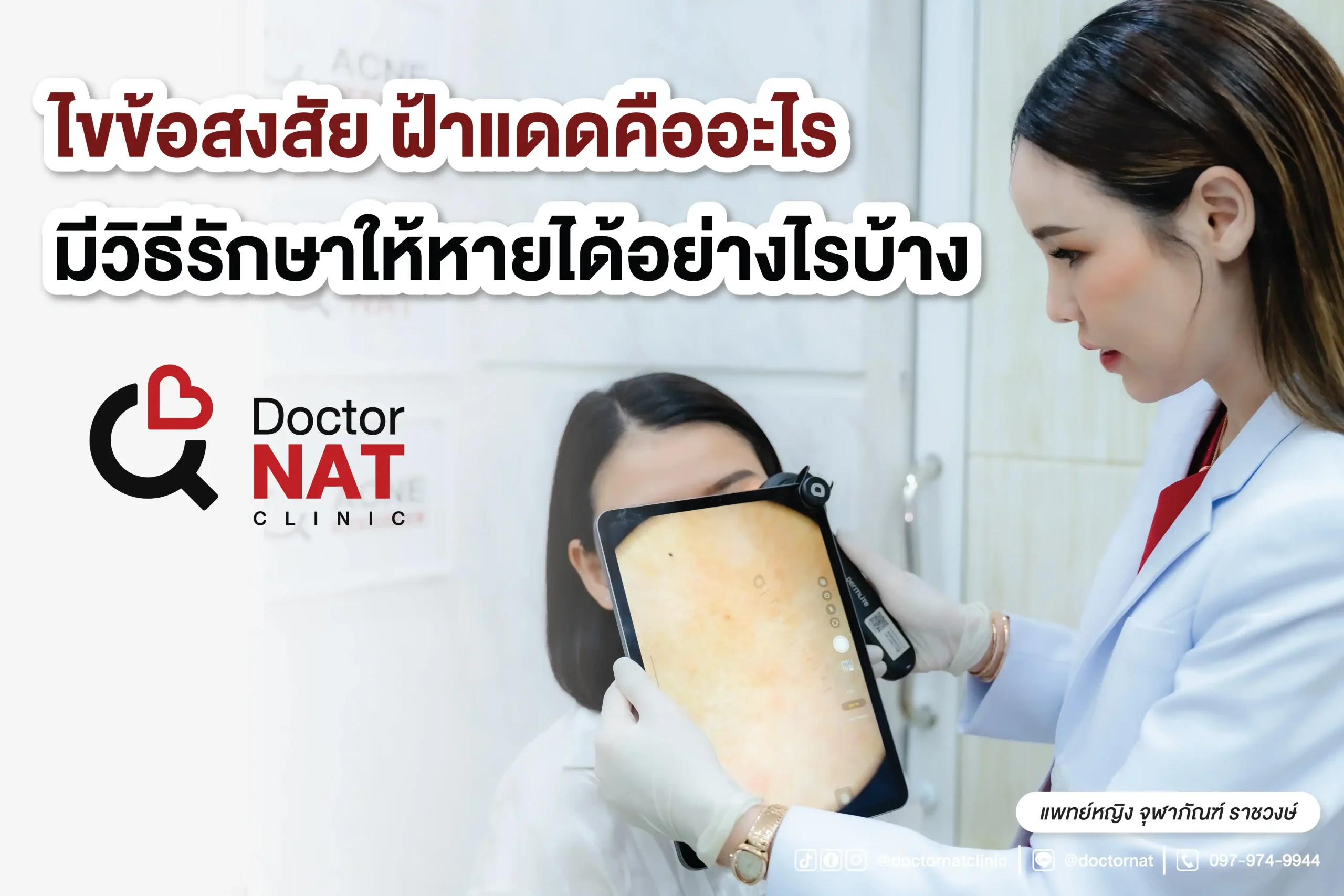 ไขข้อสงสัย ฝ้าแดดคืออะไร มีวิธีรักษาให้หายได้อย่างไรบ้าง