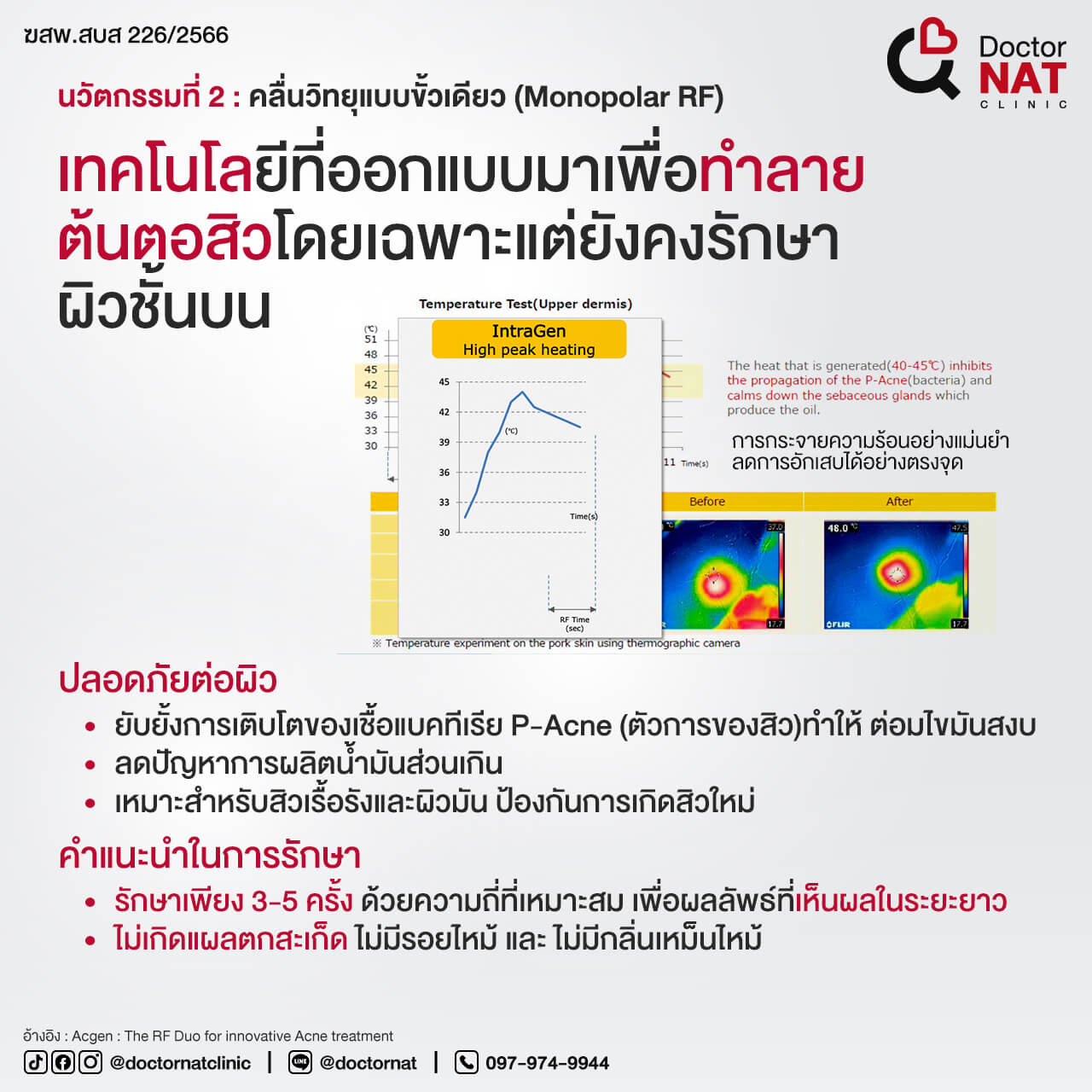 ACCLEAR รักษาสิว ฟื้นฟูผิว จากต้นตอ - Doctor NAT Clinic