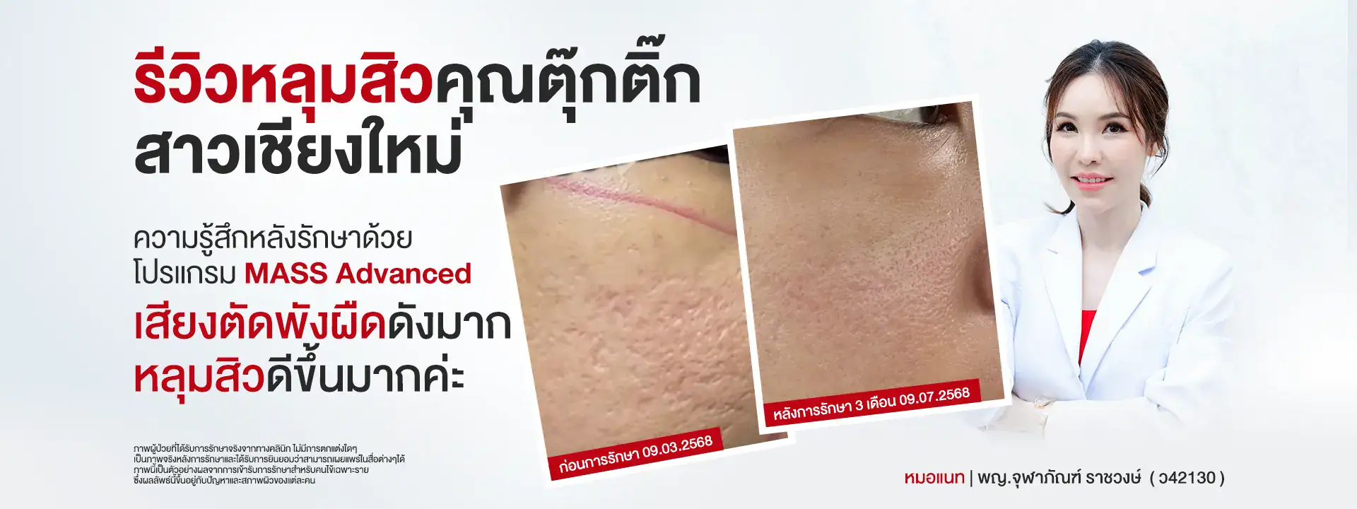 Doctor NAT Clinic รักษาสิว หลุมสิว ฝ้า