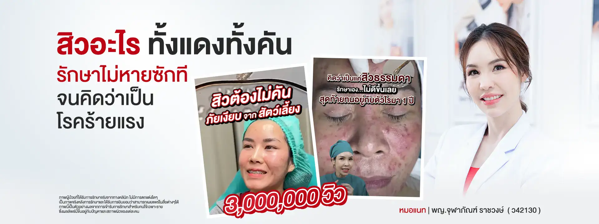 Doctor NAT Clinic รักษาสิว หลุมสิว ฝ้า